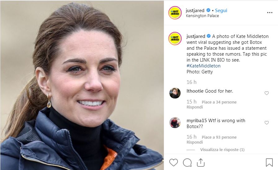 La foto di Kate Middleton con il botox diventa virale: com'è cambiato ...